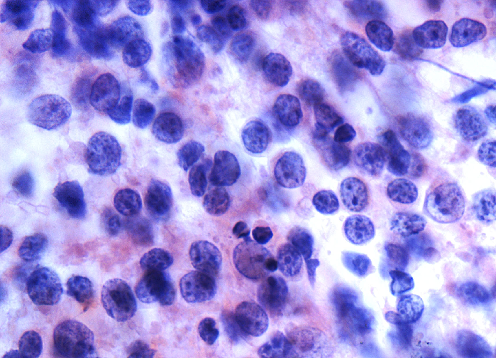 Fig. 3.10b Non-Neoplastic: Reactive Lymph Node Hyperplasia | University ...